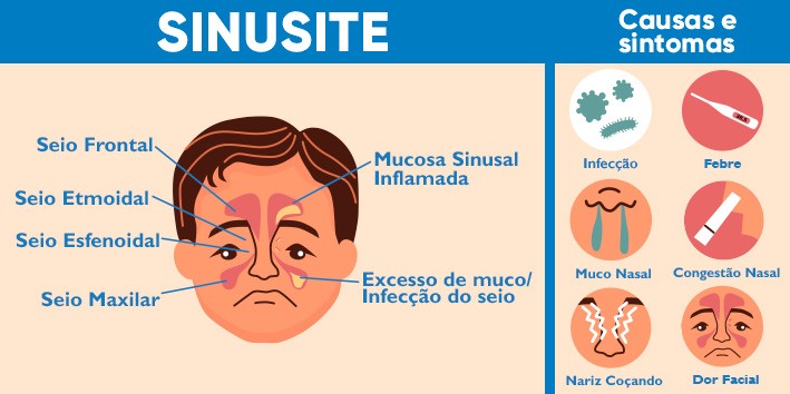A rinite atacou? Entenda os sintomas e como a fitoterapia pode ajudar!