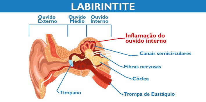Labirintite ou Vertigem? Entenda os sintomas e o que fazer!
